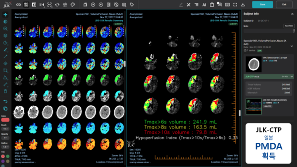 제이엘케이 뇌졸중 솔루션 JLK-CTP, 미국 FDA에 이어 일본 PMDA 인허가 획득